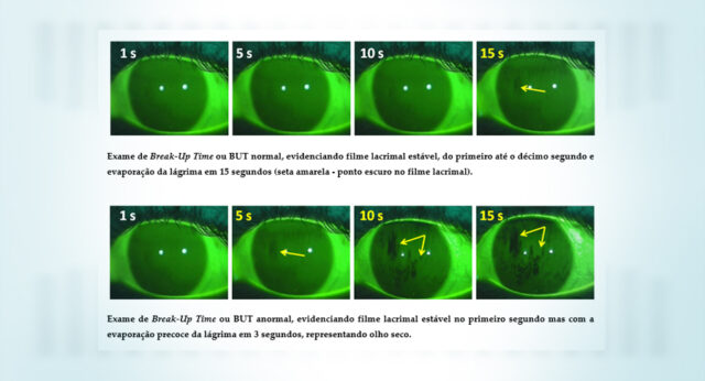 BUT – Break Up Time – AUDIOVISÃO Centro Médico